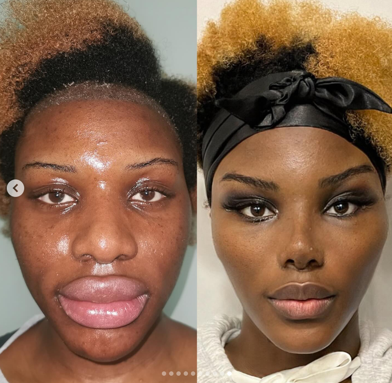 מזקנה ומכוערת הפכה להיות יפה וצעירה - FXP